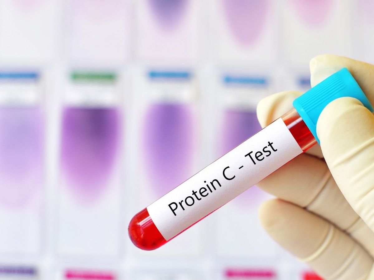 Proteína C Reactiva: Valores y Significado